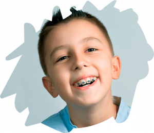 Brackets para niños en Las Palmas – B.Kids